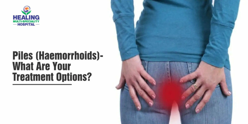 Piles (Haemorrhoids) – What Are Your Treatment Options? - Healing Hospital