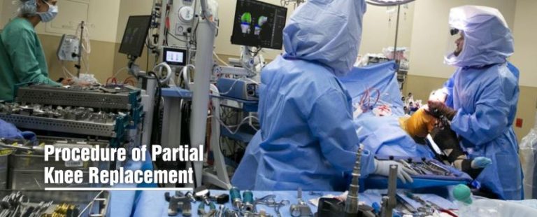 A Patient's Guide to Partial Knee Replacement - Healing Hospital