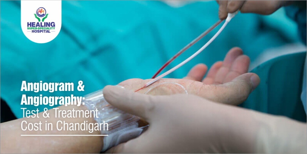 Angiogram & Angiography: Test & Treatment Cost in Chandigarh - Healing ...