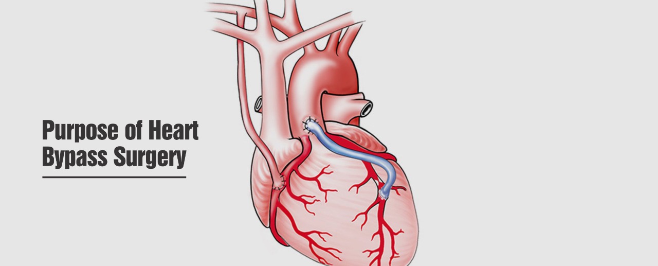 Best Doctor for Heart Bypass Surgery in Chandigarh - Healing Hospital