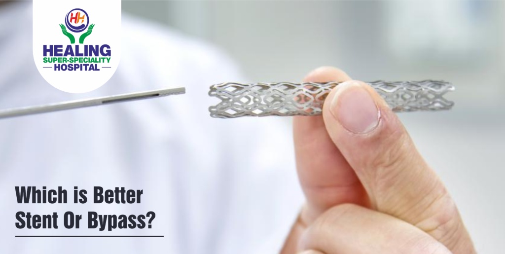 Which is Better Stent or Bypass? - Healing Hospital