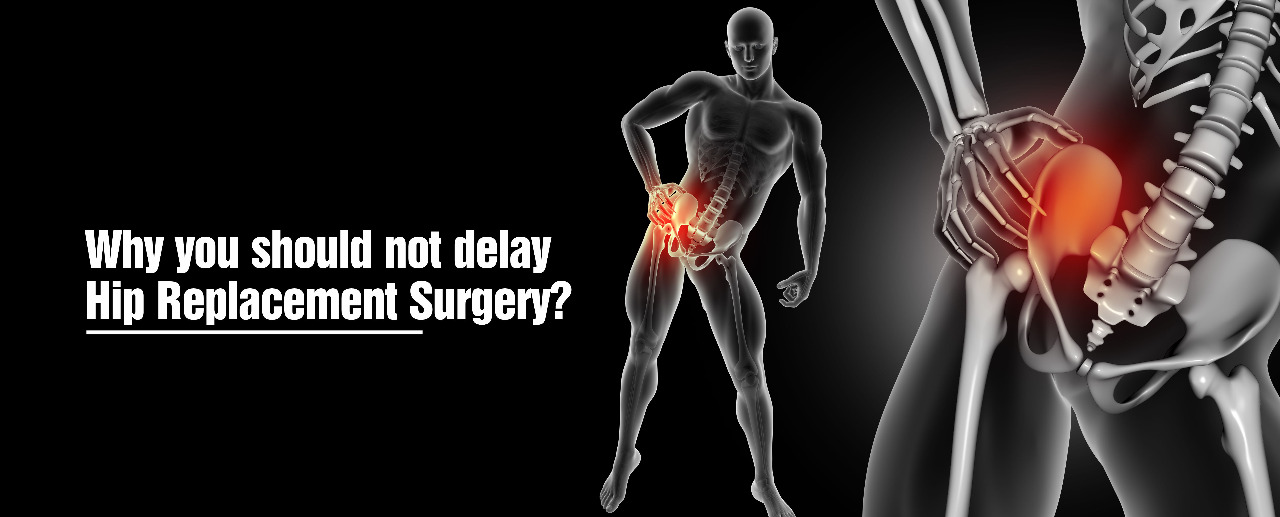 Why Should You Get Hip Replacements As Early As Possible? - Healing ...