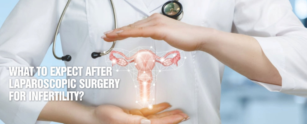 LAPAROSCOPY FOR INFERTILITY - Healing Hospital