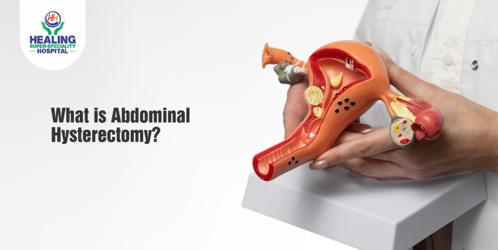 What is Abdominal Hysterectomy? - Healing Hospital