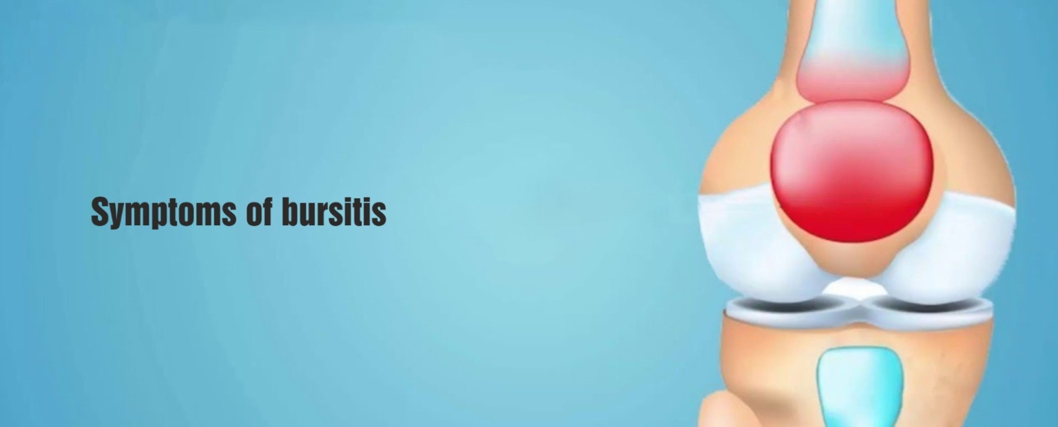 Understanding Bursitis: Symptoms, Prevention, and Cure