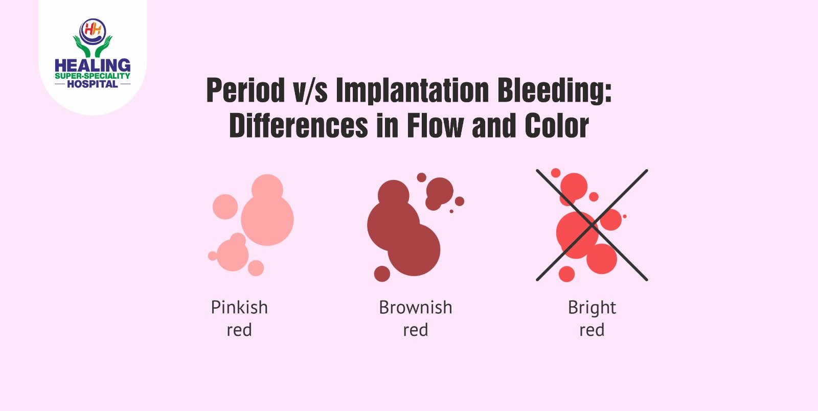 Menstrual Bleeding Vs Implantation Bleeding Menstrual Bleeding Vs Implantation Bleeding
